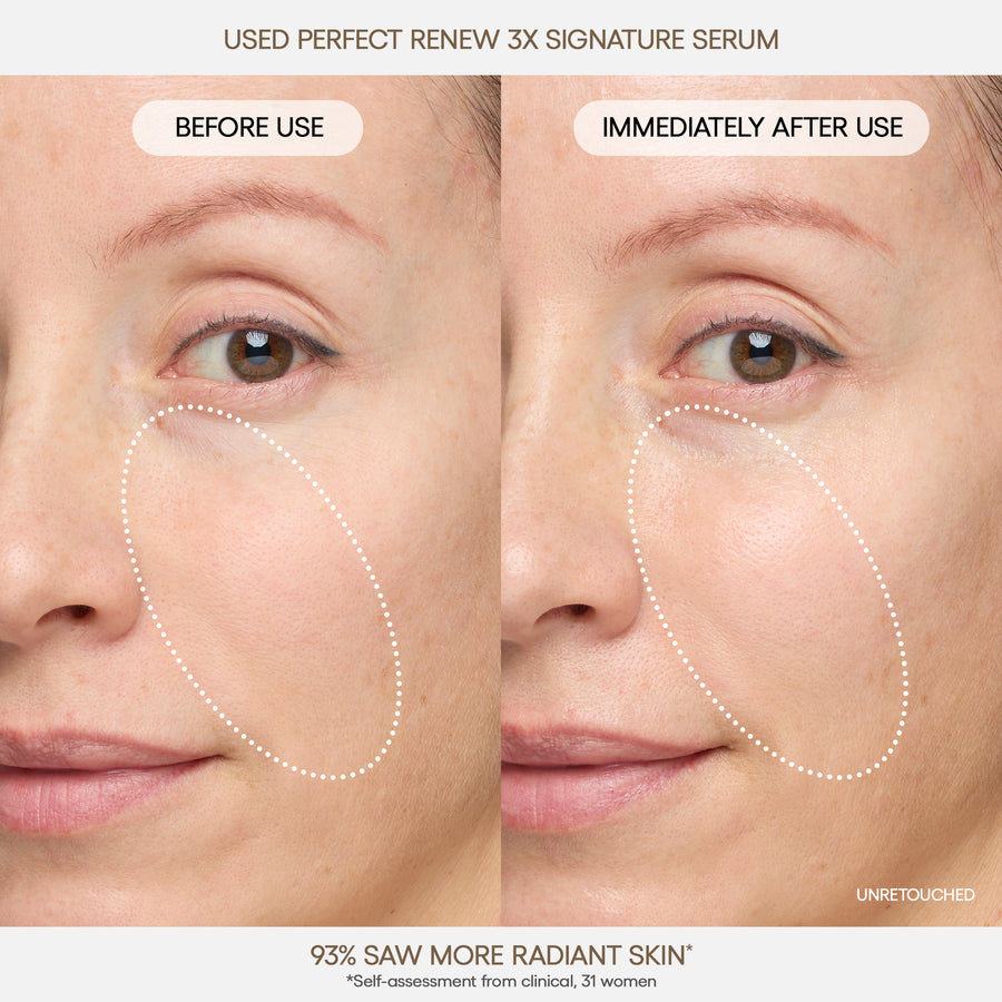 Perfect Renew 3X Signature Serum | LANEIGE